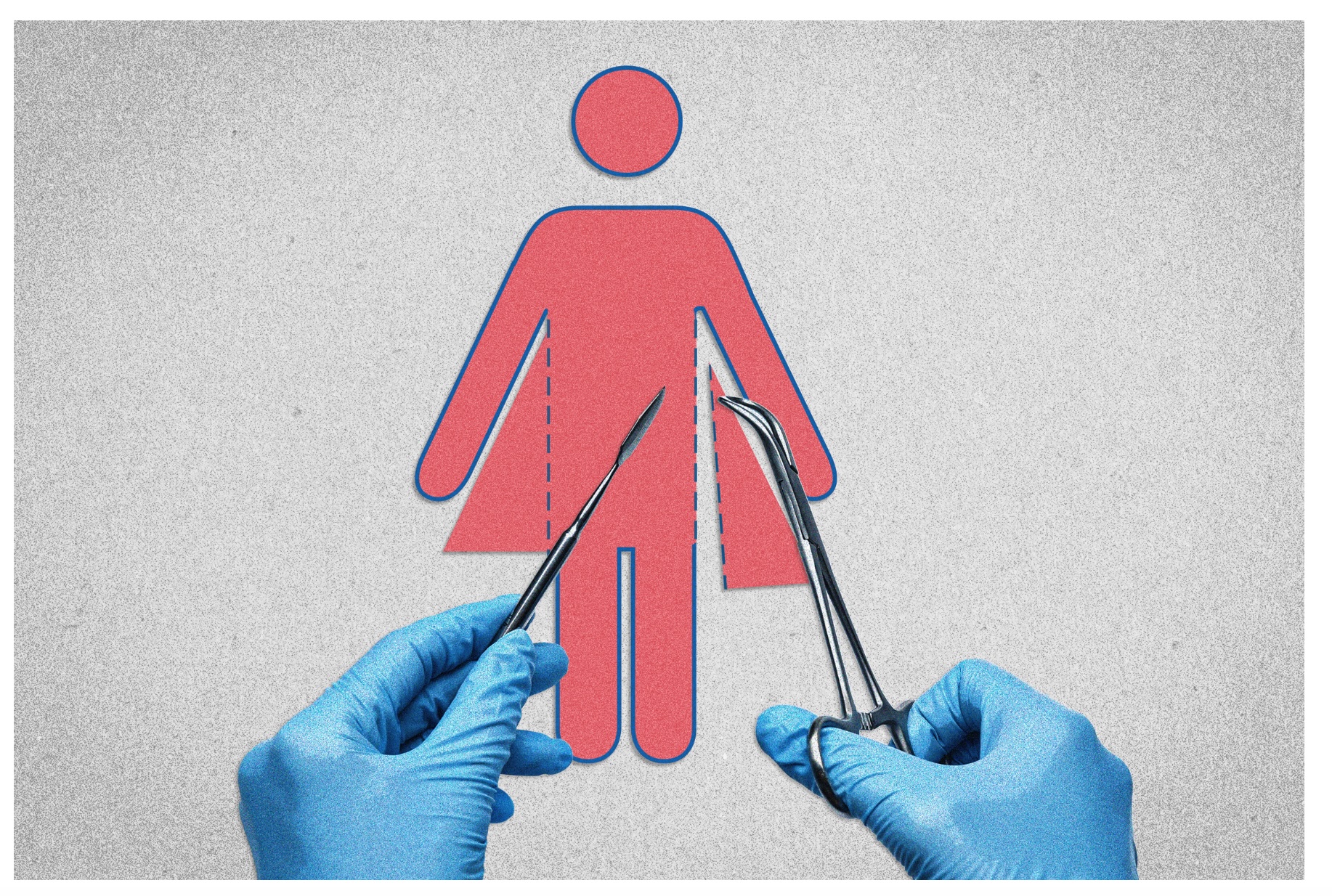Landmark $2 Million Trans Surgery Verdict Marks a Turning Point - James ...